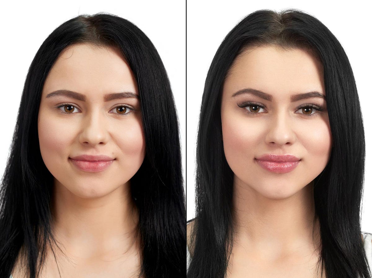 Botox for TMJ in NYC: Impact on Face Shape? | Medium