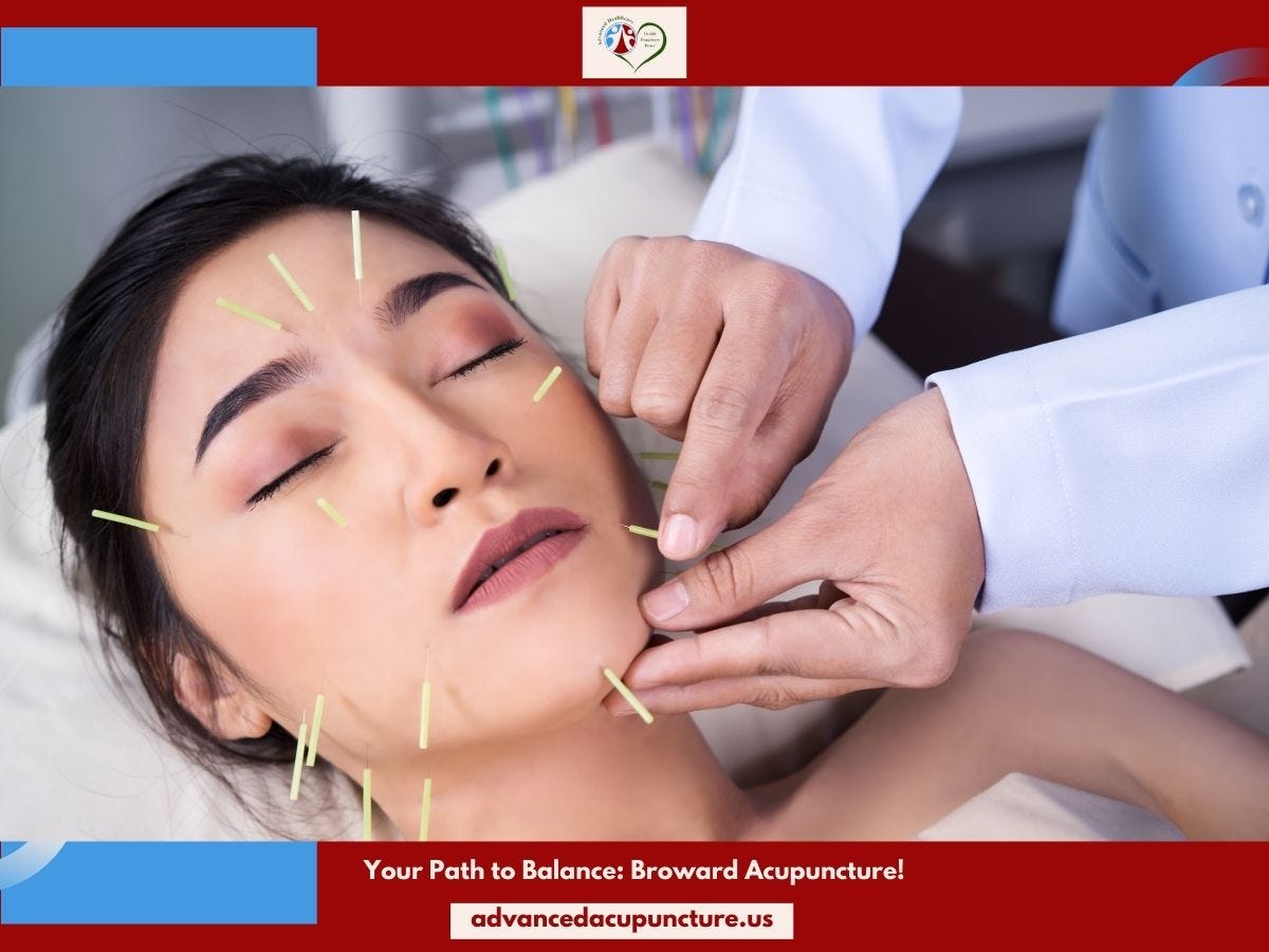 Chinese Acupuncture — Hollywood Florida By Advanced Acupuncture Apr 2024 Medium