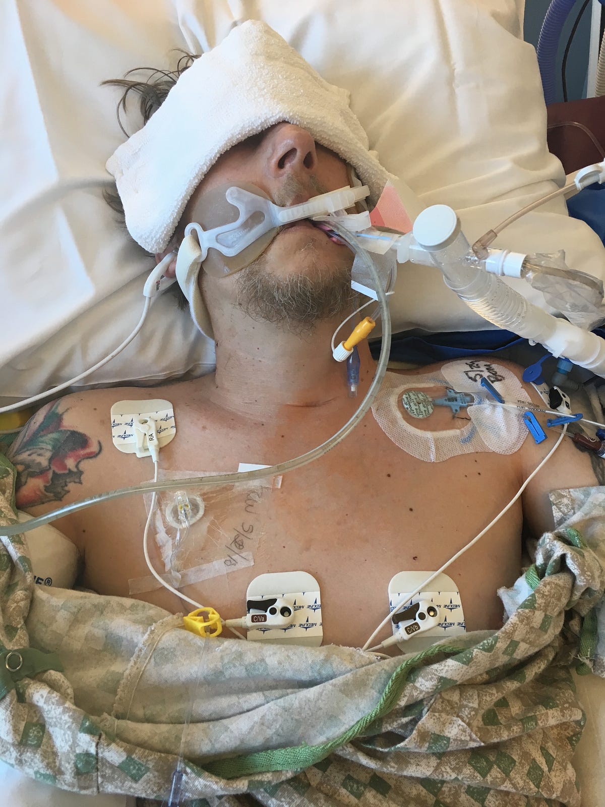 Misguided End-of-Life Support. Would Pope Francis have been allowed to… | by Garry W. Lambert ...