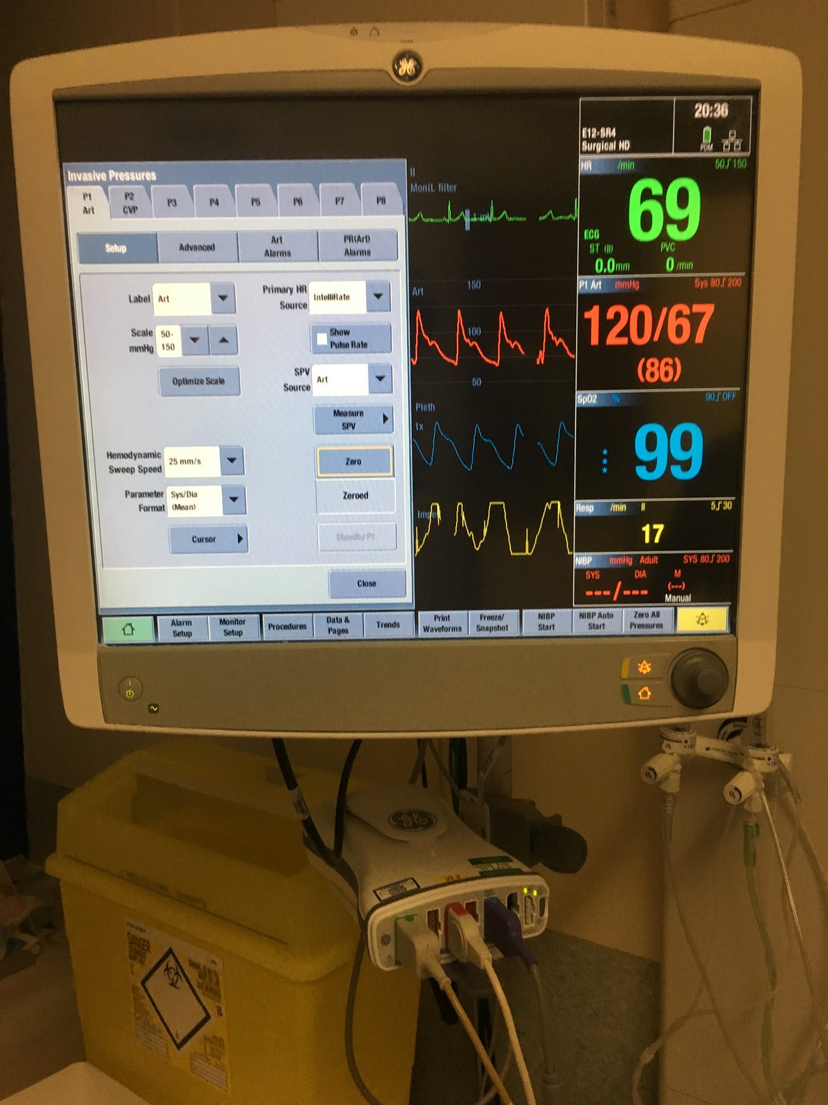 Day 1 Post Op — 15th November 2017 | by Daisy Rees | Medium