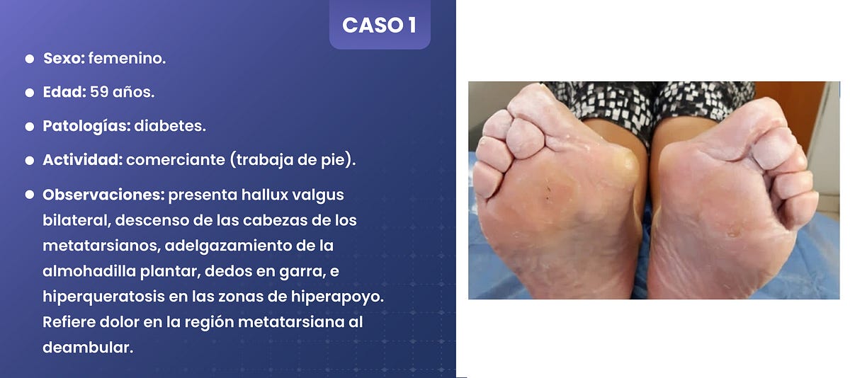 Hiperqueratosis plantar. Hiperqueratosis plantar | by Ebers Med | Medium
