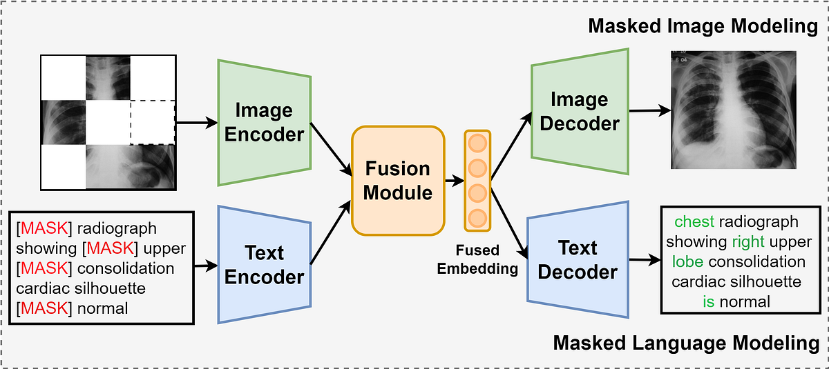 Fine-Tuning a Vision-Language Model for Classifying Chest X-Ray ...