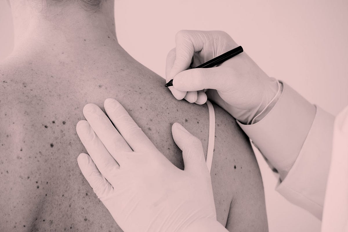 Skin Cancer Checks Burwood - Elevate Medical - Medium