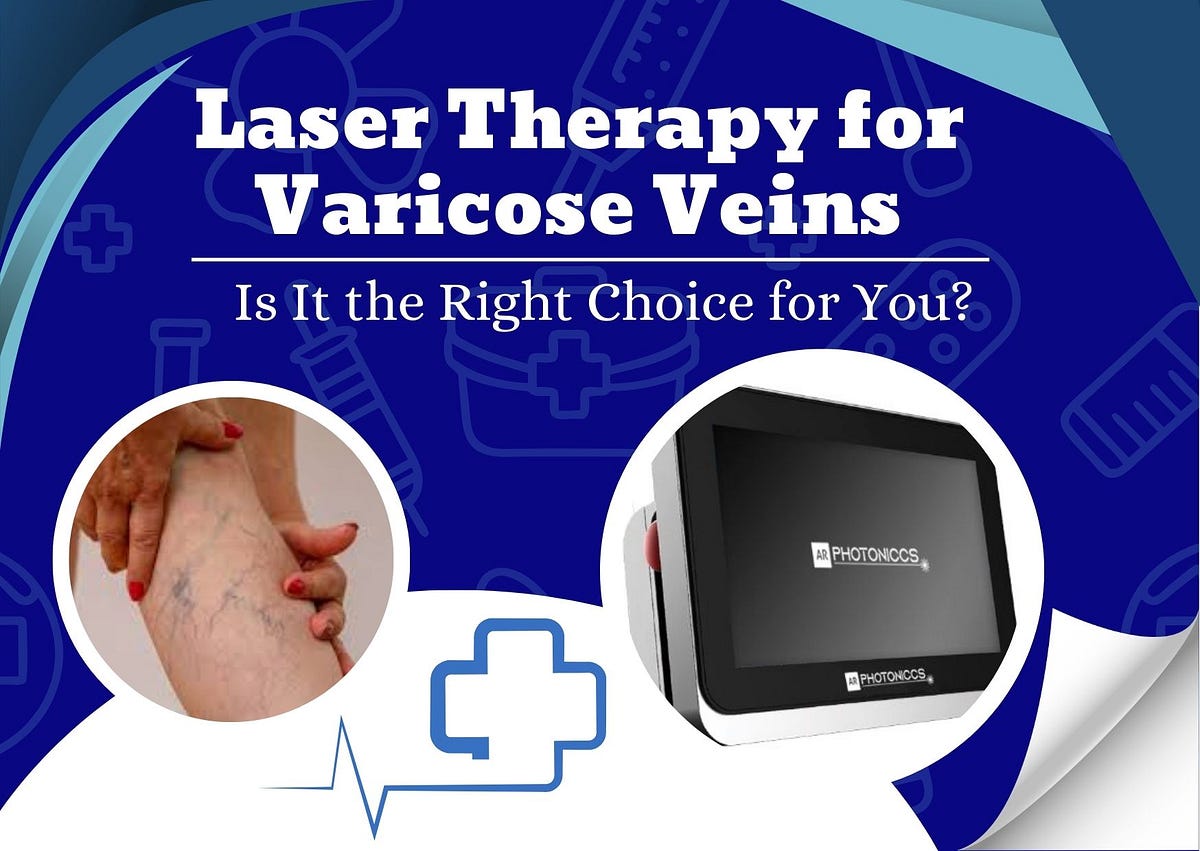 Laser Therapy for Varicose Veins: Is It the Right Choice for You? | by ...