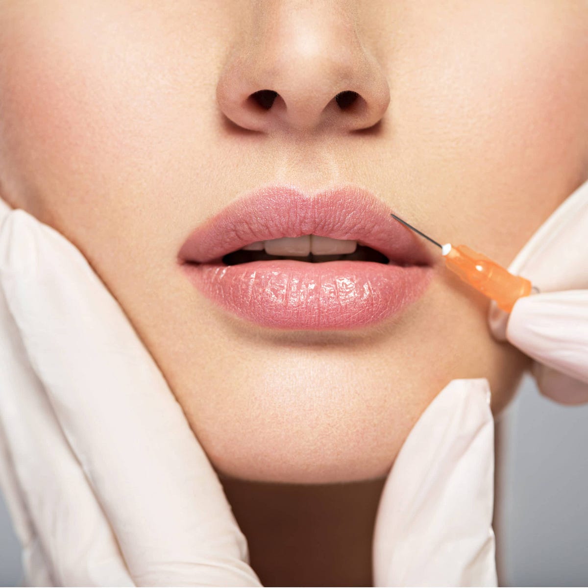 The Future of Fullness: Exploring Cutting-Edge Lip Filler Options | by ...