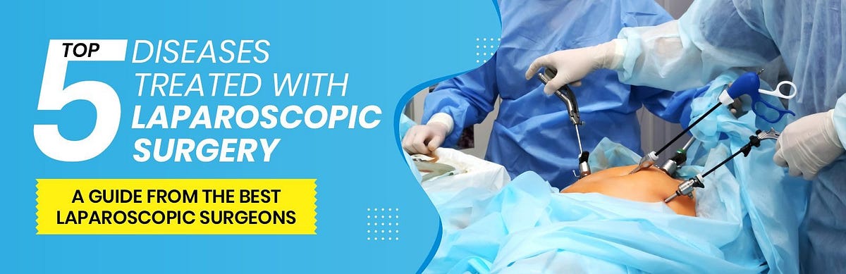 Top 5 Diseases Treated with Laparoscopic Surgery: A Guide from the Best Laparoscopic Surgeons ...