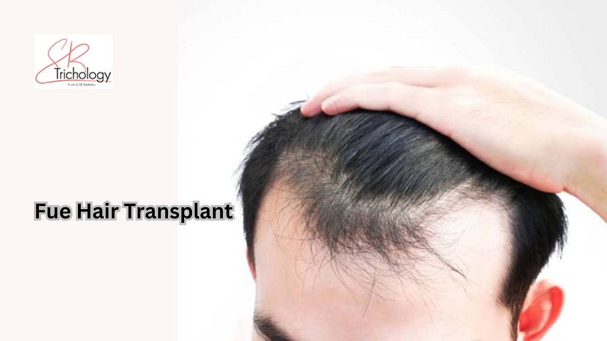 Ultimate Guide to Hair Transplant: How It Works and What to Expect | by ...