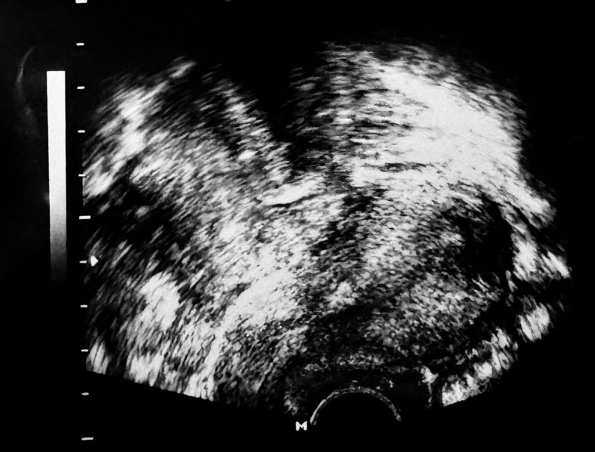 The galaxy. This is my womb, and no, I’m not… | by Moujan Ardani | Nov ...