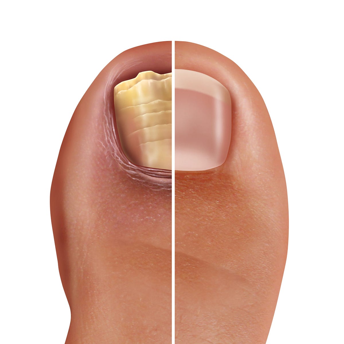 The Healing Journey of Nails: Shedding the Old and Growing Anew | by ...