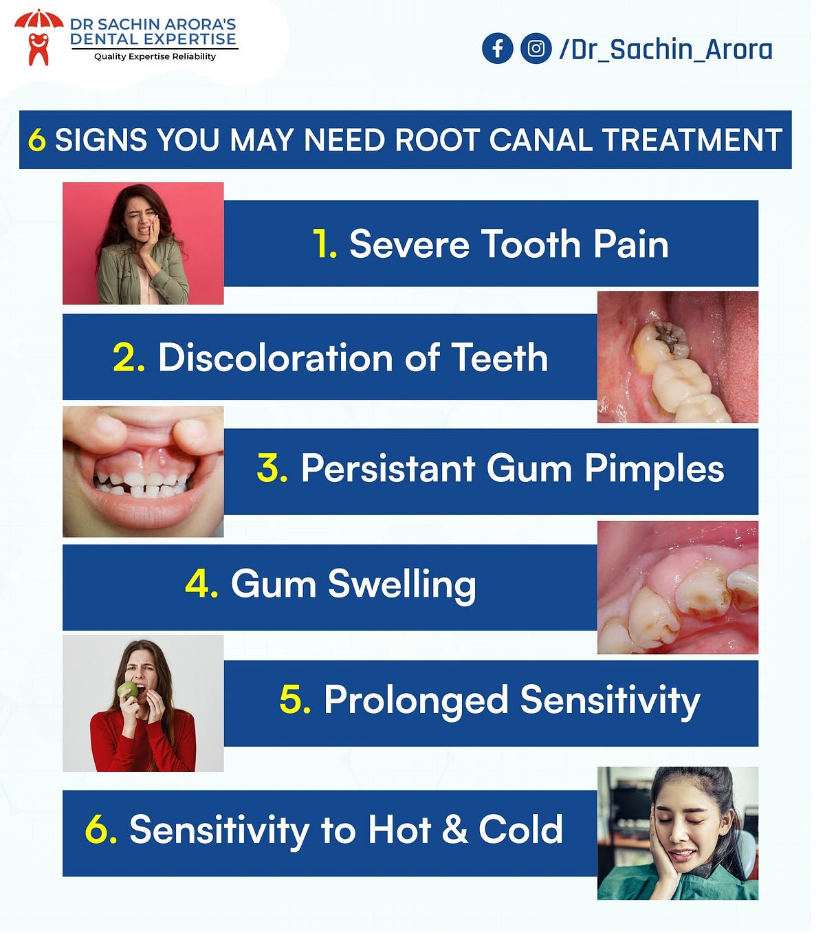 SIGNS YOU MAY NEED A ROOT CANAL TREATMENT - Dr. Sachin Arora - Medium