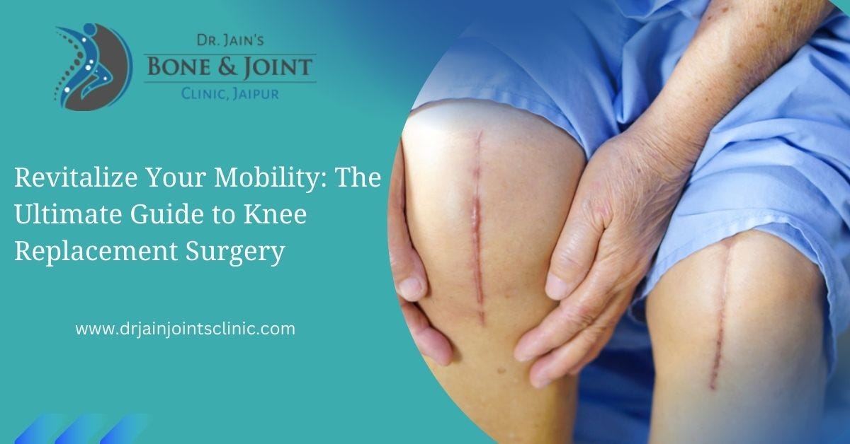 Revitalize Your Mobility: The Ultimate Guide to Knee Replacement ...