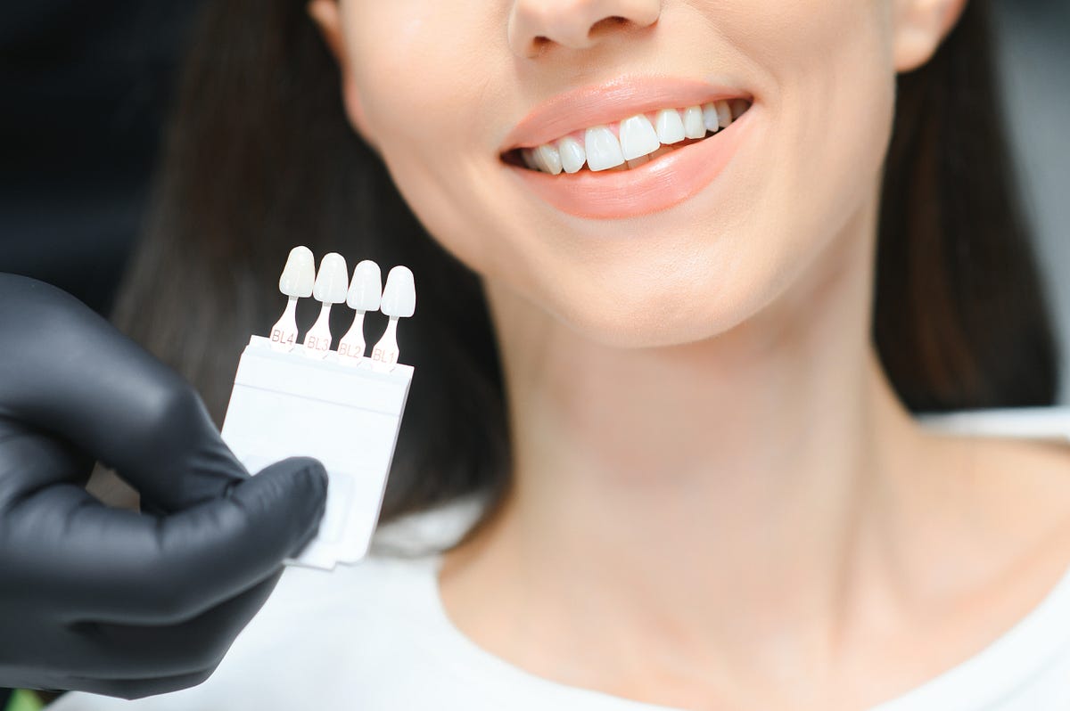 Porcelain Perfection: The Magic of Dental Veneers Revealed | by ...