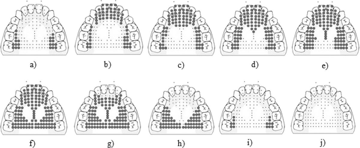 Electropalatography & Articulation | by Kasey Anderson | Medium