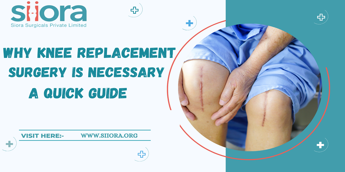 Why Knee Replacement Surgery is Necessary? A Quick Guide - Siora ...
