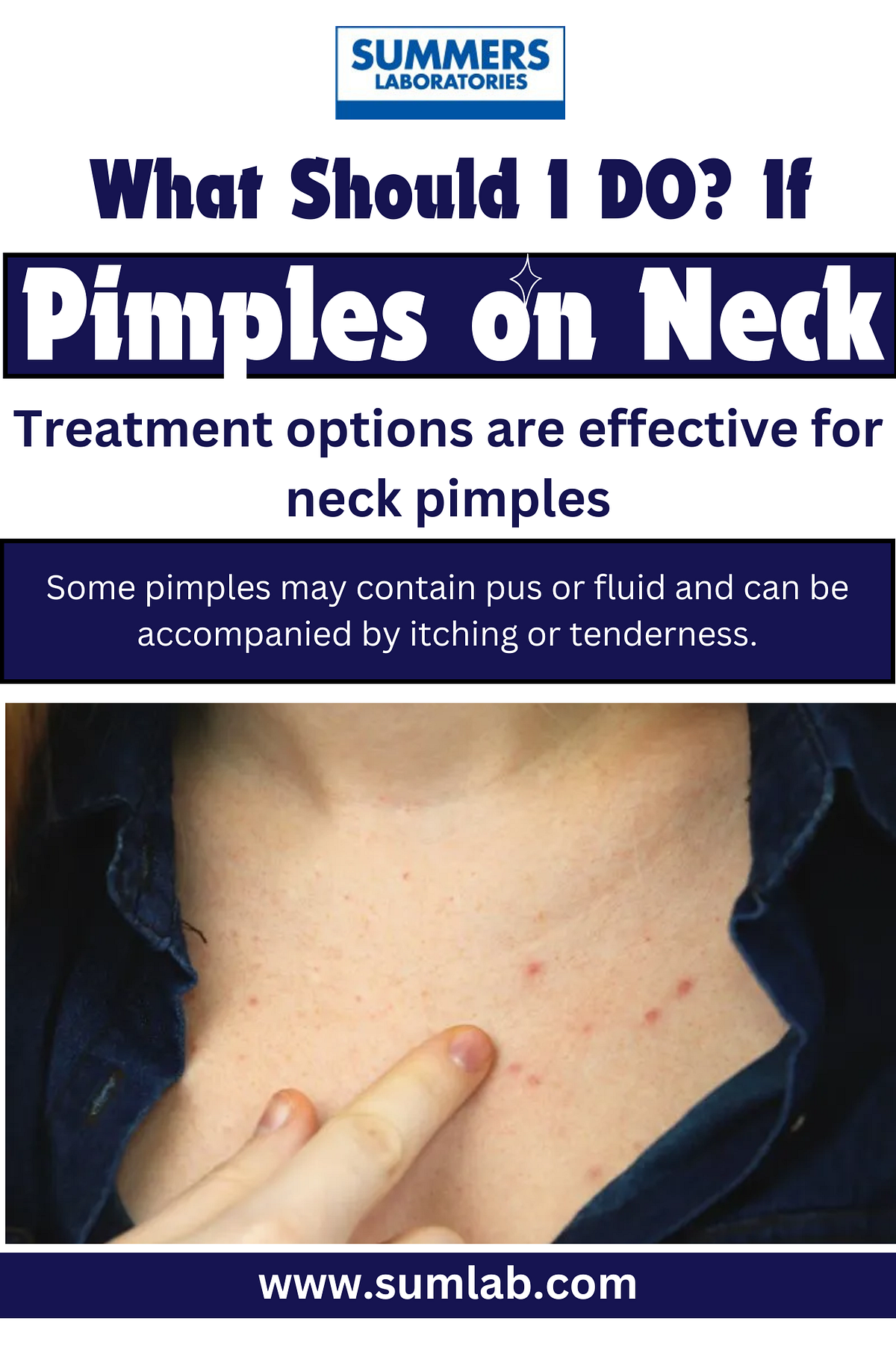 What symptoms should I look for to identify if I have neck pimples ...