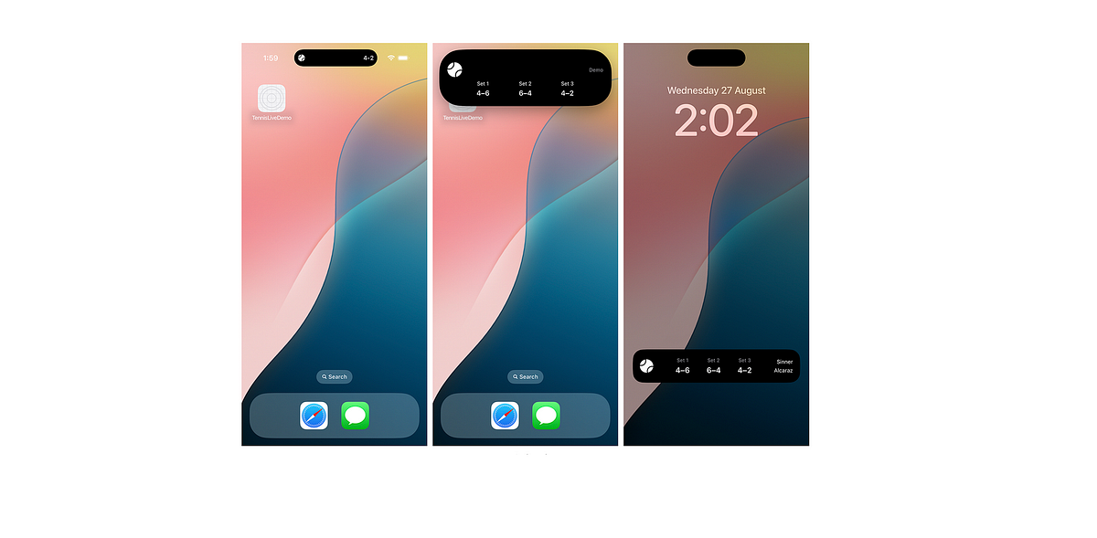 iOS Live Activities in Expo React Native with Dynamic Data: | by Kathan ...