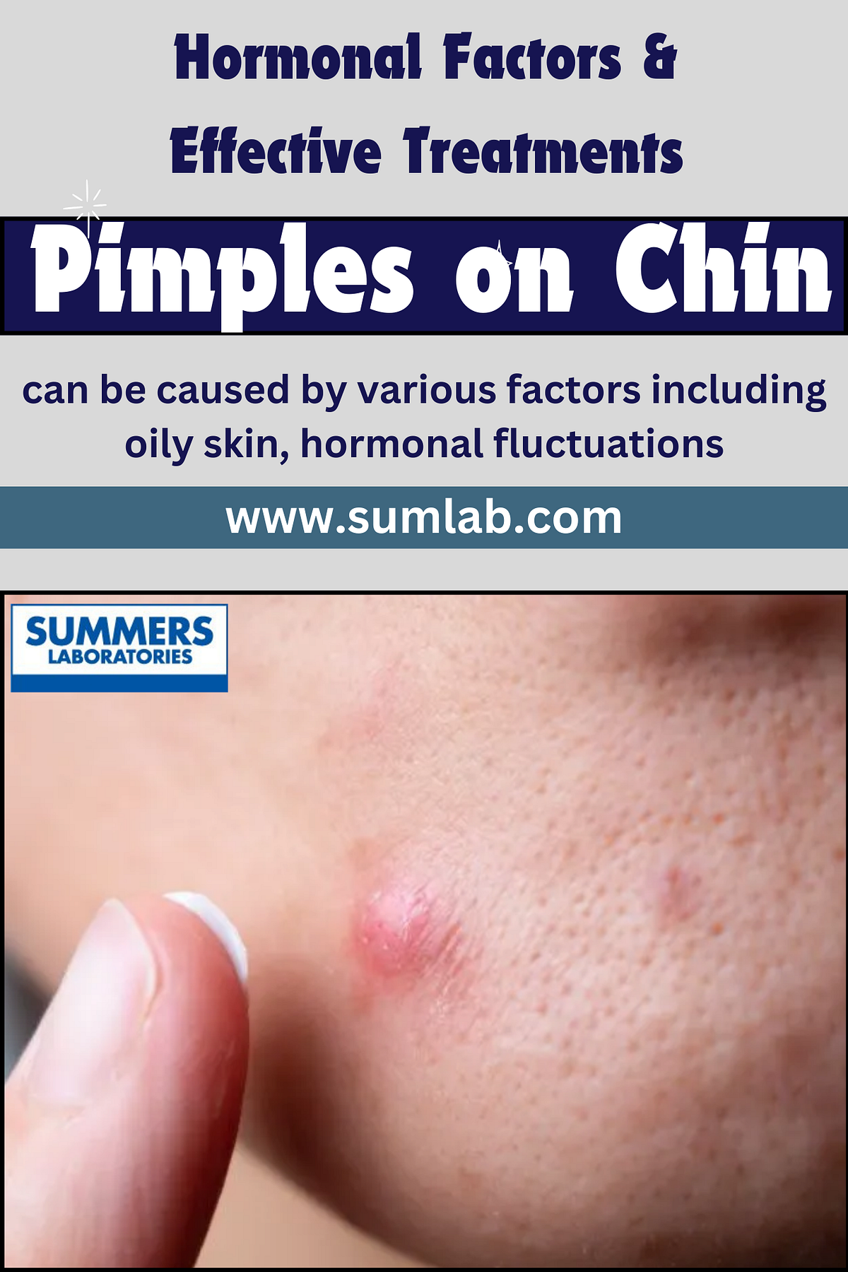 How do I stop pimples from growing on my chin? - Summerslaboratories ...