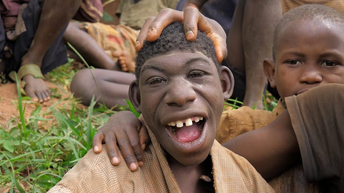 THE MONKEY TYPE HUMAN. This child looks like the monkey. He always got ...