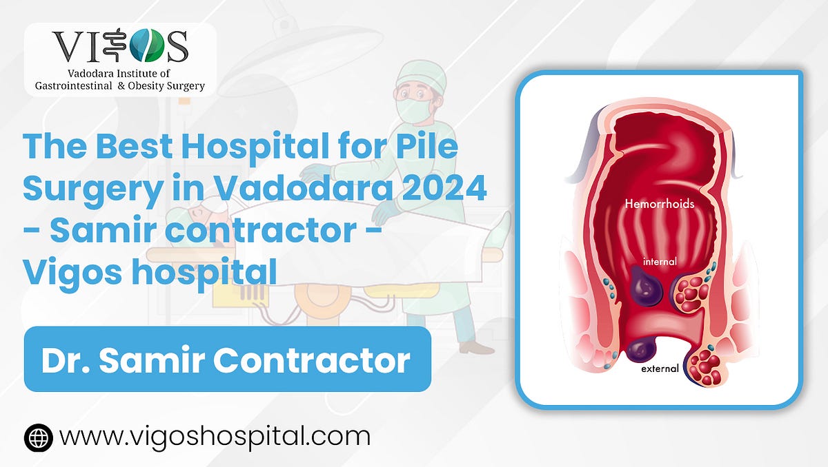 The Best Hospital for Pile Surgery in Vadodara 2024 | Samir contractor ...