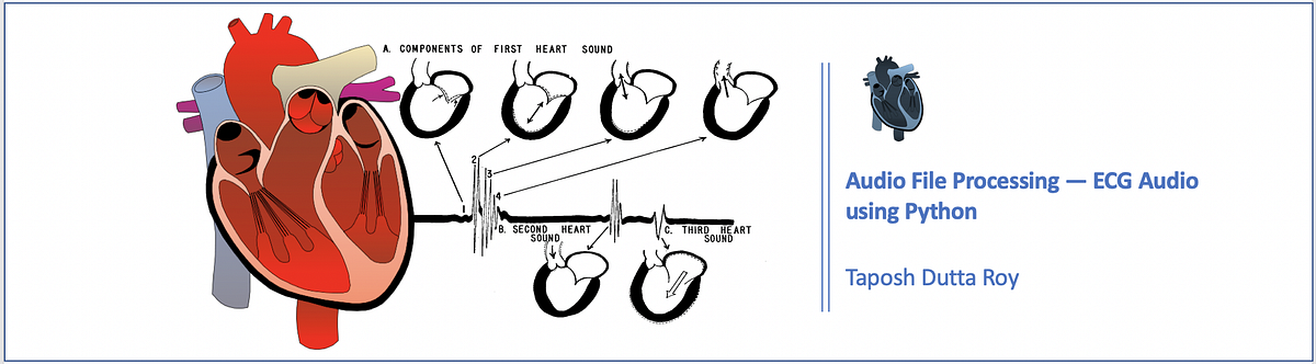 Audio File Processing — ECG Audio using Python | by Taposh Dutta-Roy ...