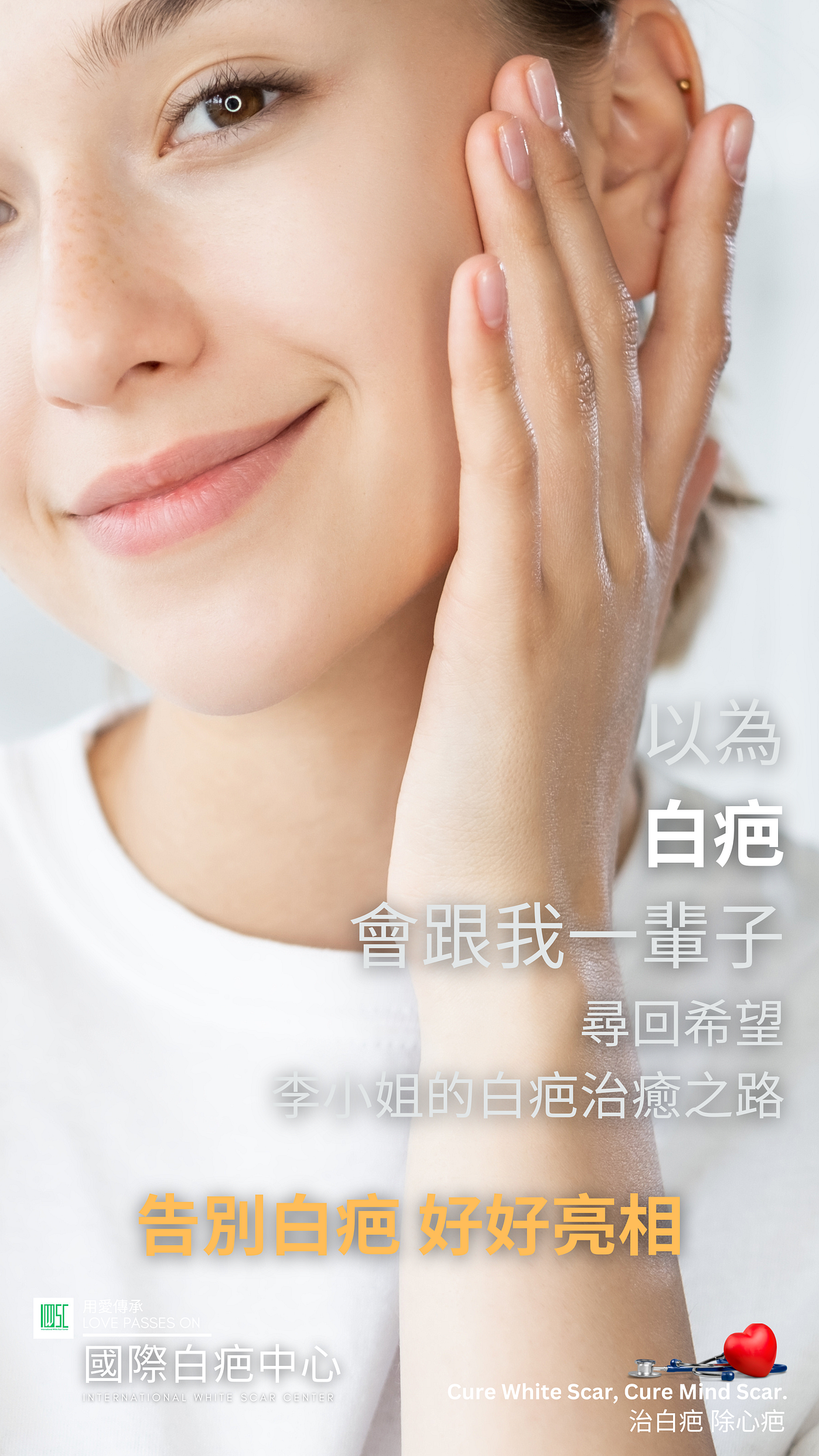 #White Scar — Finding Hope: Ms. Li’s Journey to Healing White Scars on ...