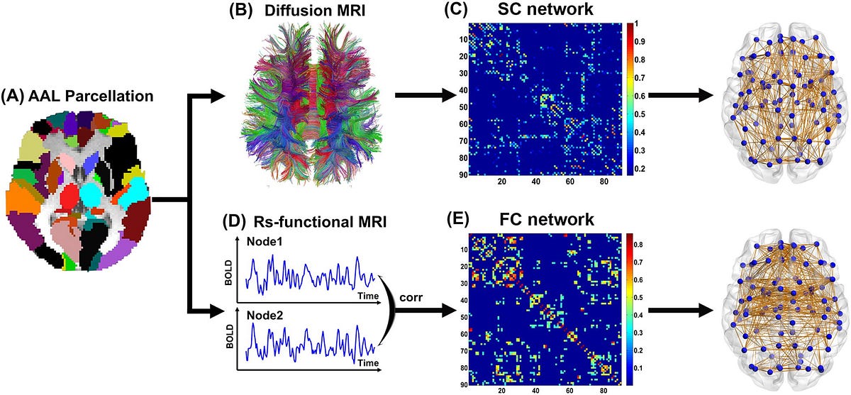 A Brief Introduction To Functional Connectomics By Mikey Taylor The Startup Medium