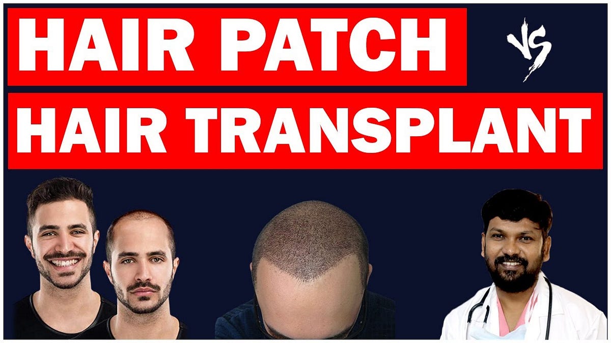 Hair Transplant Vs Hair Patch: Which is Better? | Dr John Watts | by Dr ...