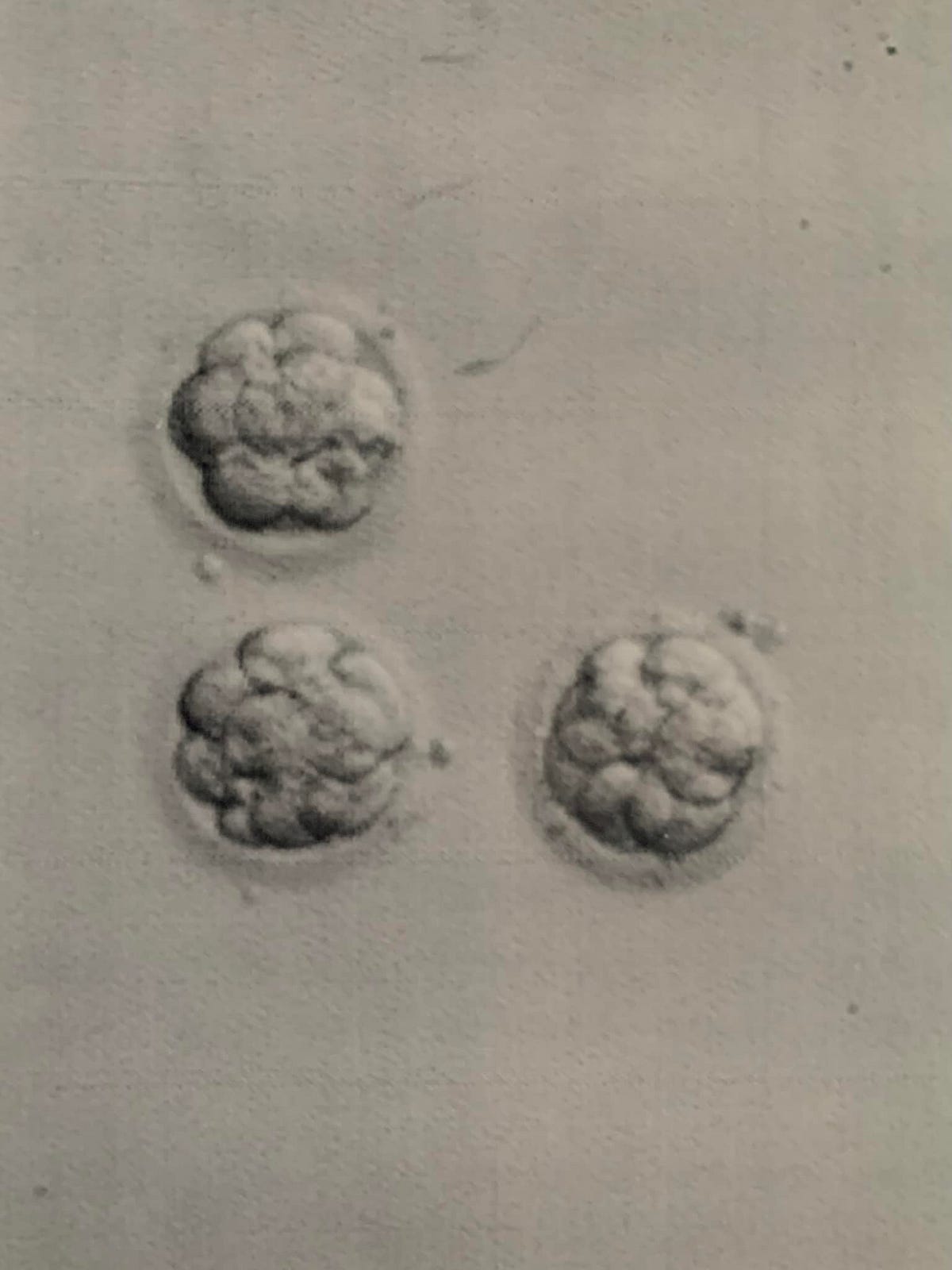 Five weeks, 16 cells, 1 vote.. As someone who went through years of ...