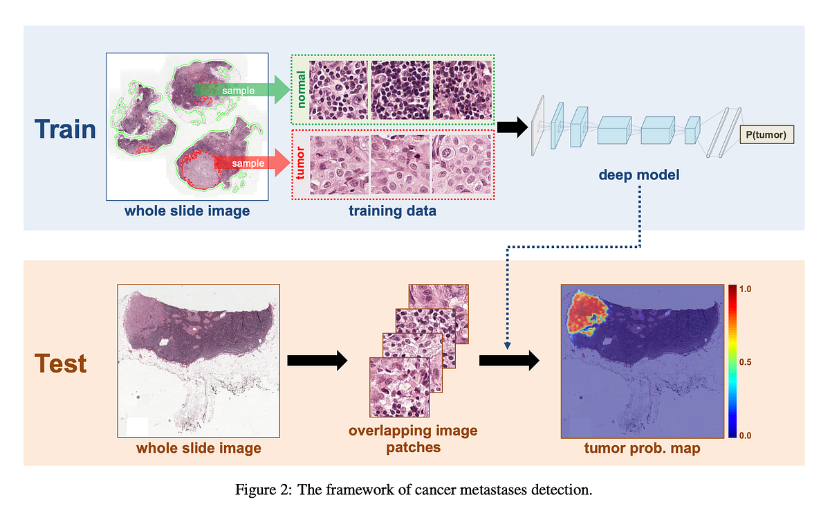 AI revolutionizes pathology and cancer control (PathAI) | by DiploDoc ...