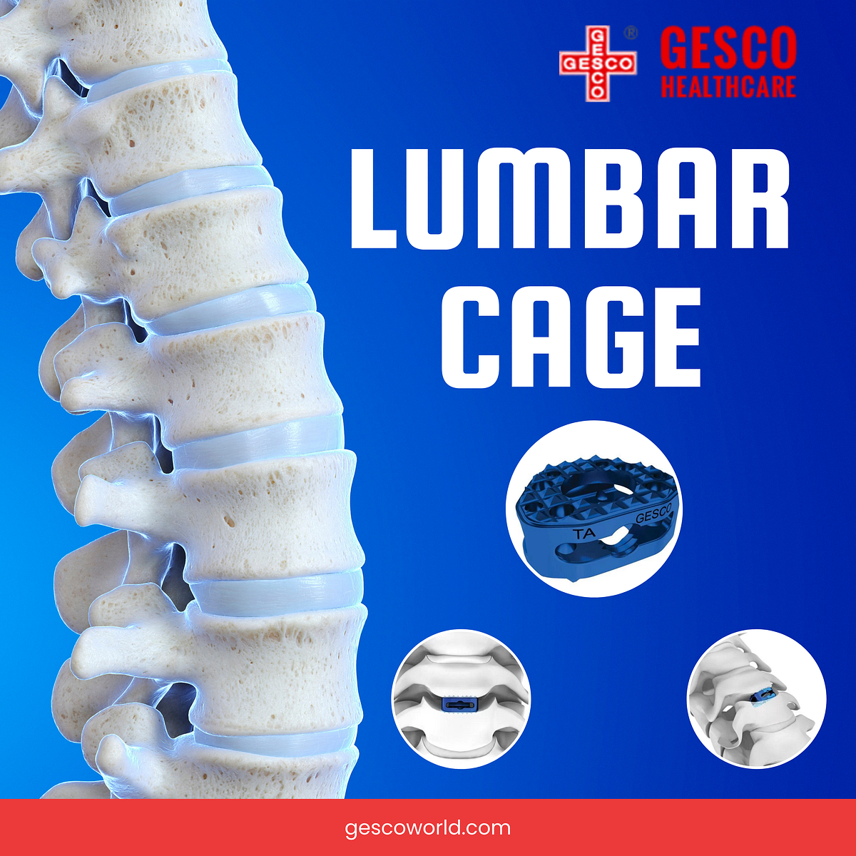 Lumber Cage - Gesco Healthcare - Medium