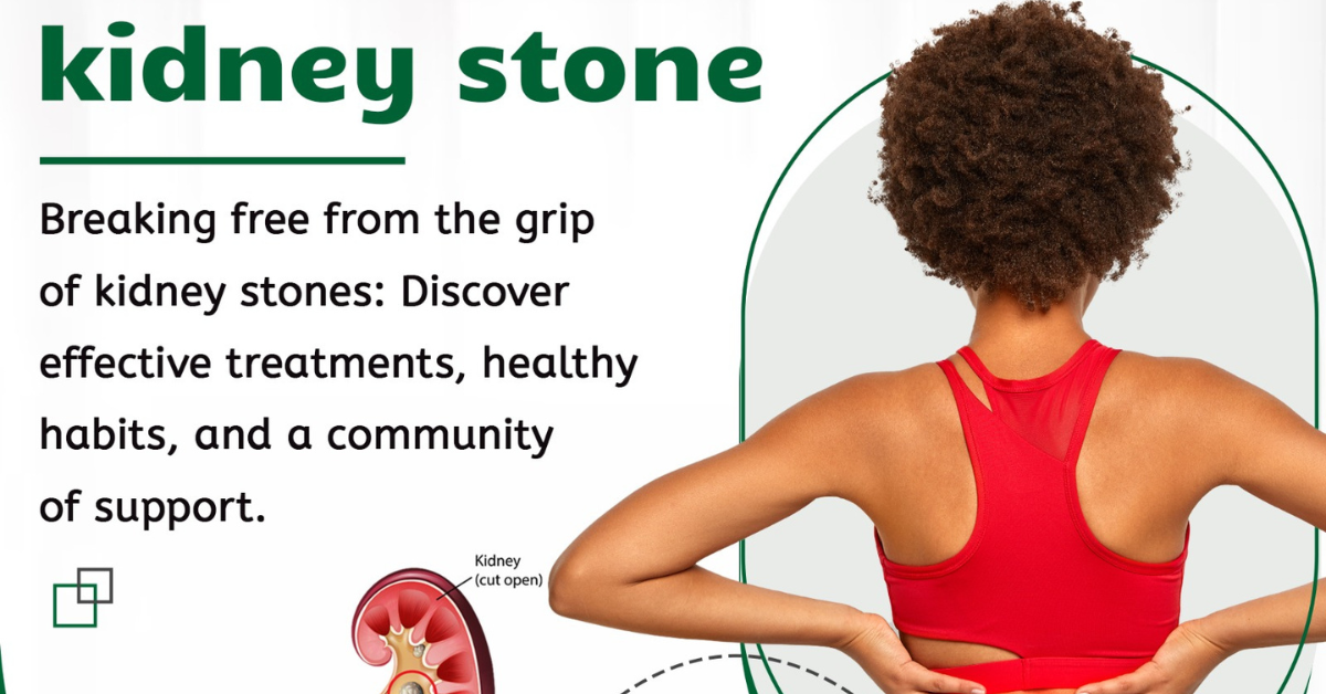 Laser Stone Surgery: A Cutting-Edge Approach to Kidney Stone Treatment ...