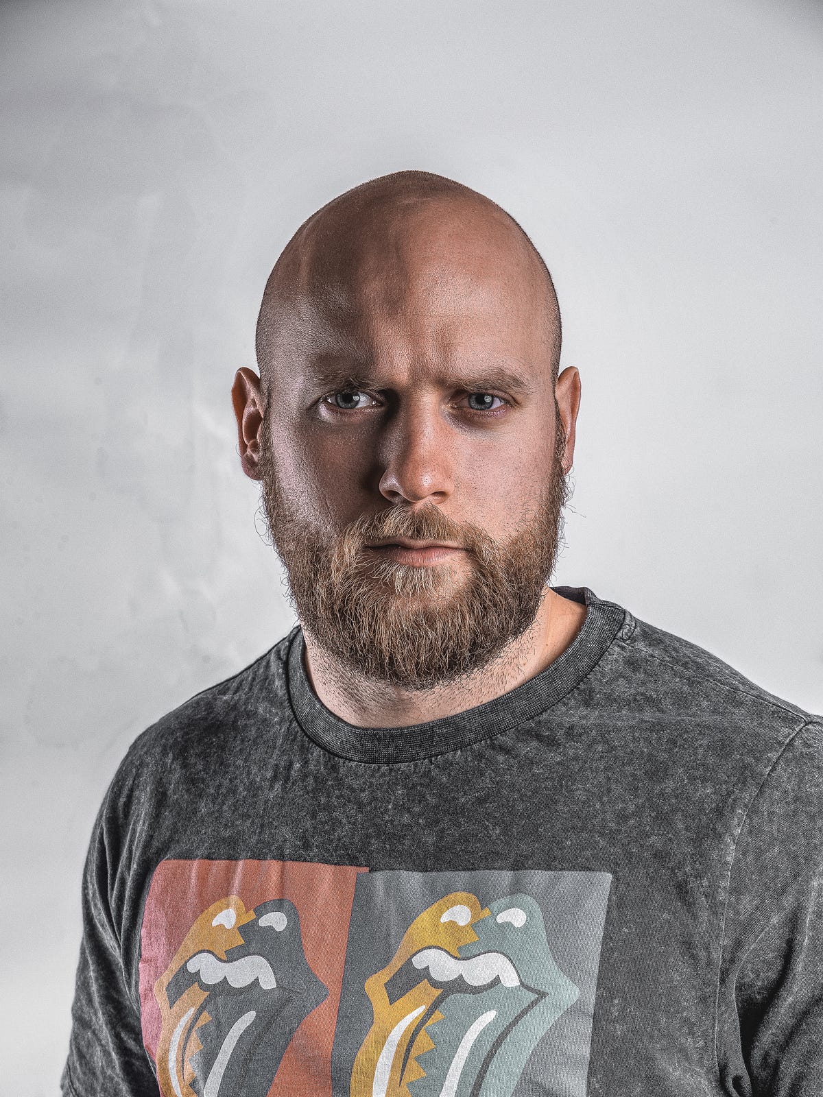 Receding Recovery! Style Out Your Baldness Today! | by Adam Robinson ...