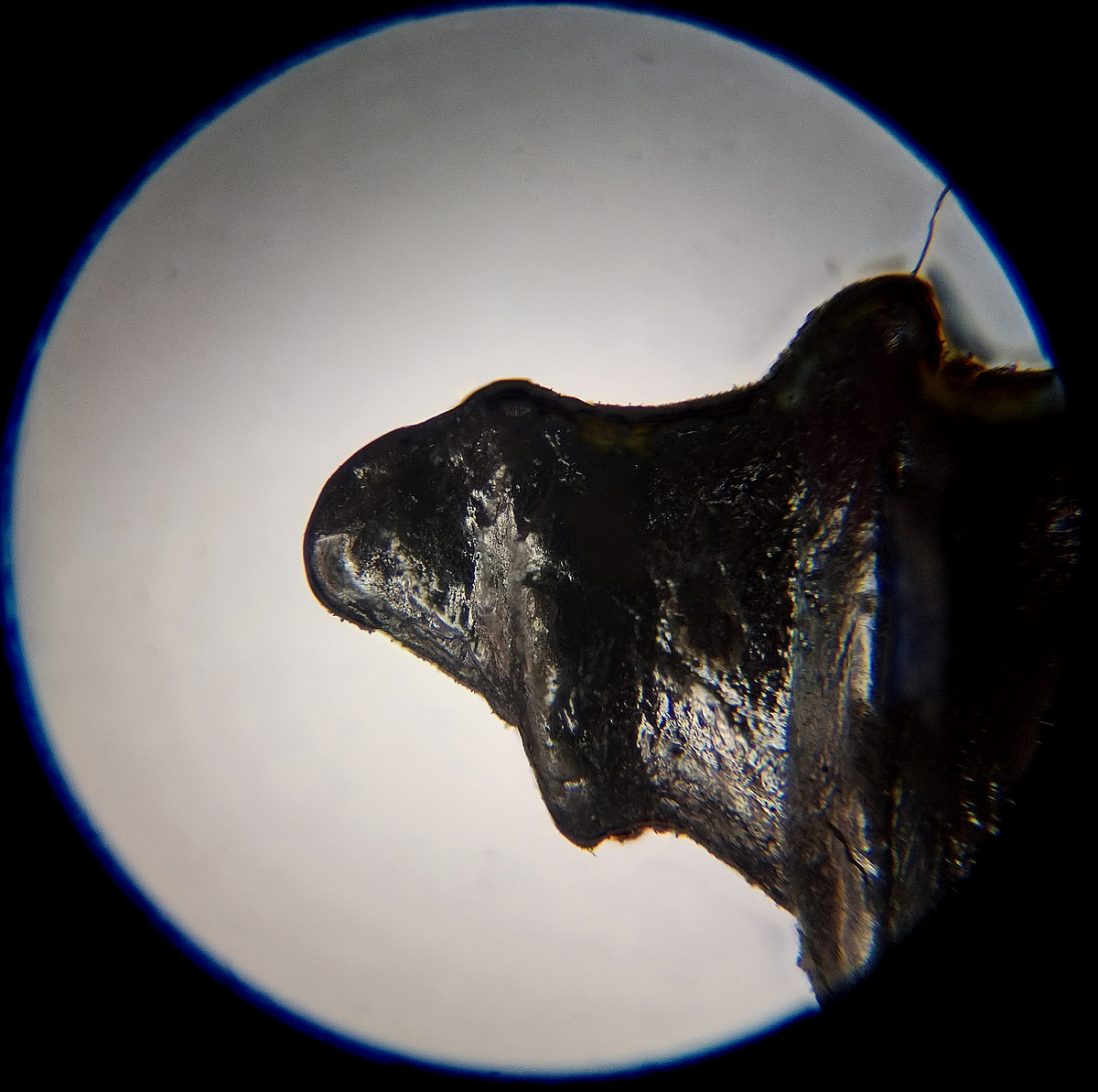 Microscopy: Nails, Bristles, and a Special Drawing | by Shrean Rafiq ...