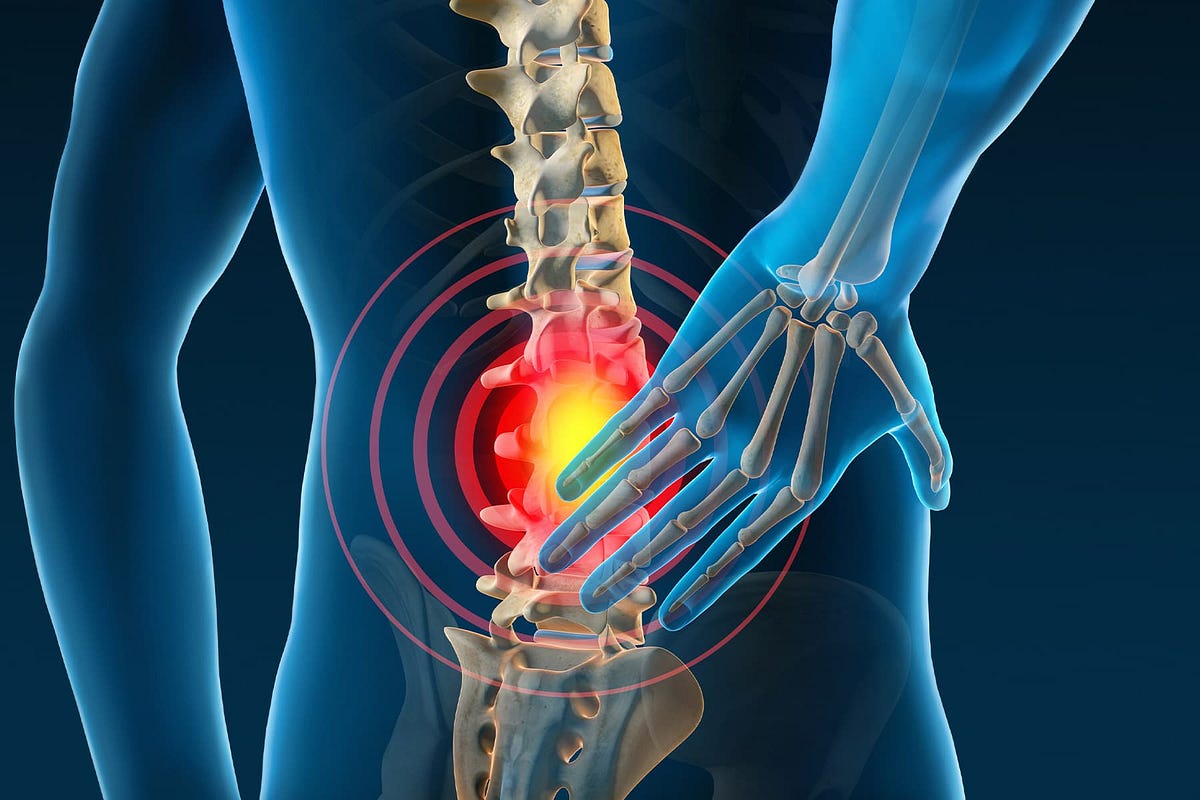 Back pain and its causes?. Dorsalgia (also called “Back Pain”) is… | by ...