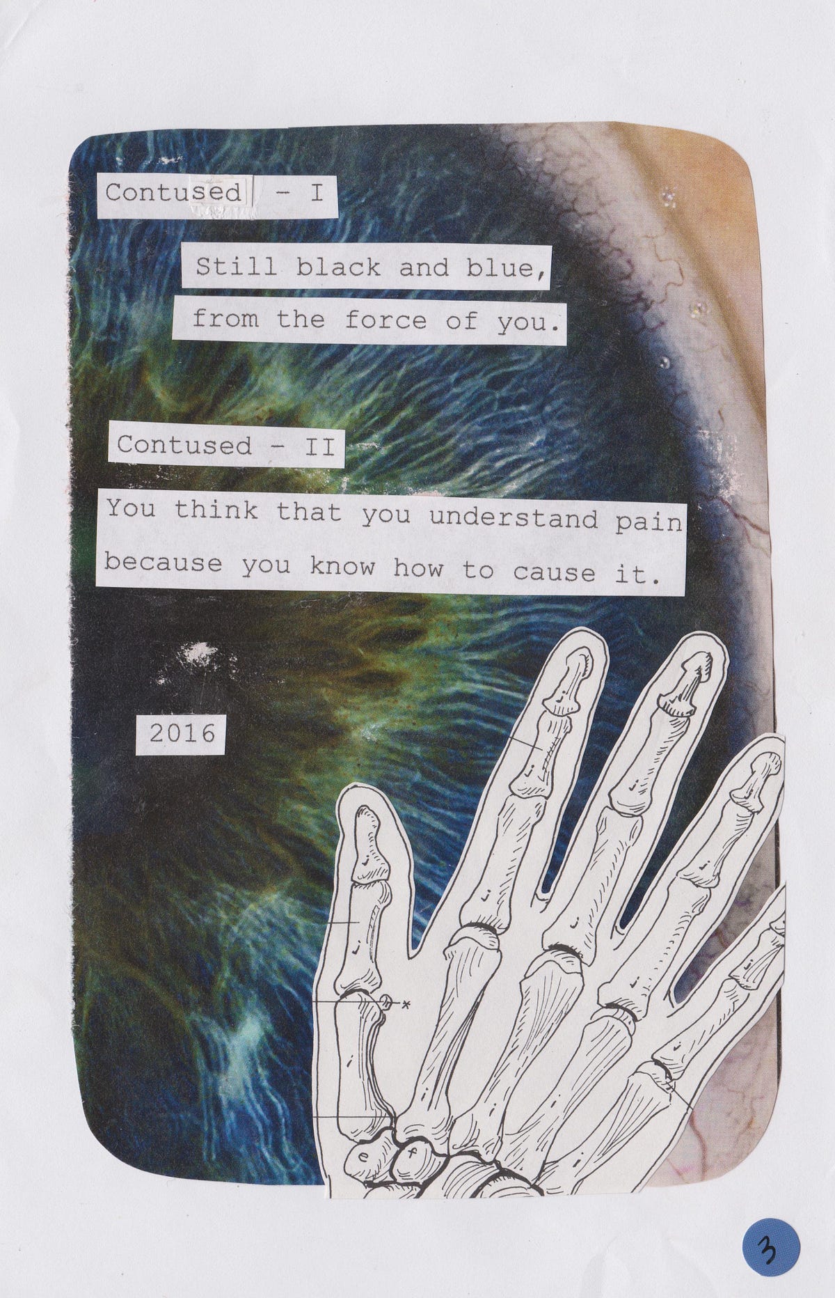 Contused — II. You think that you understand pain | by poor grrl | Medium