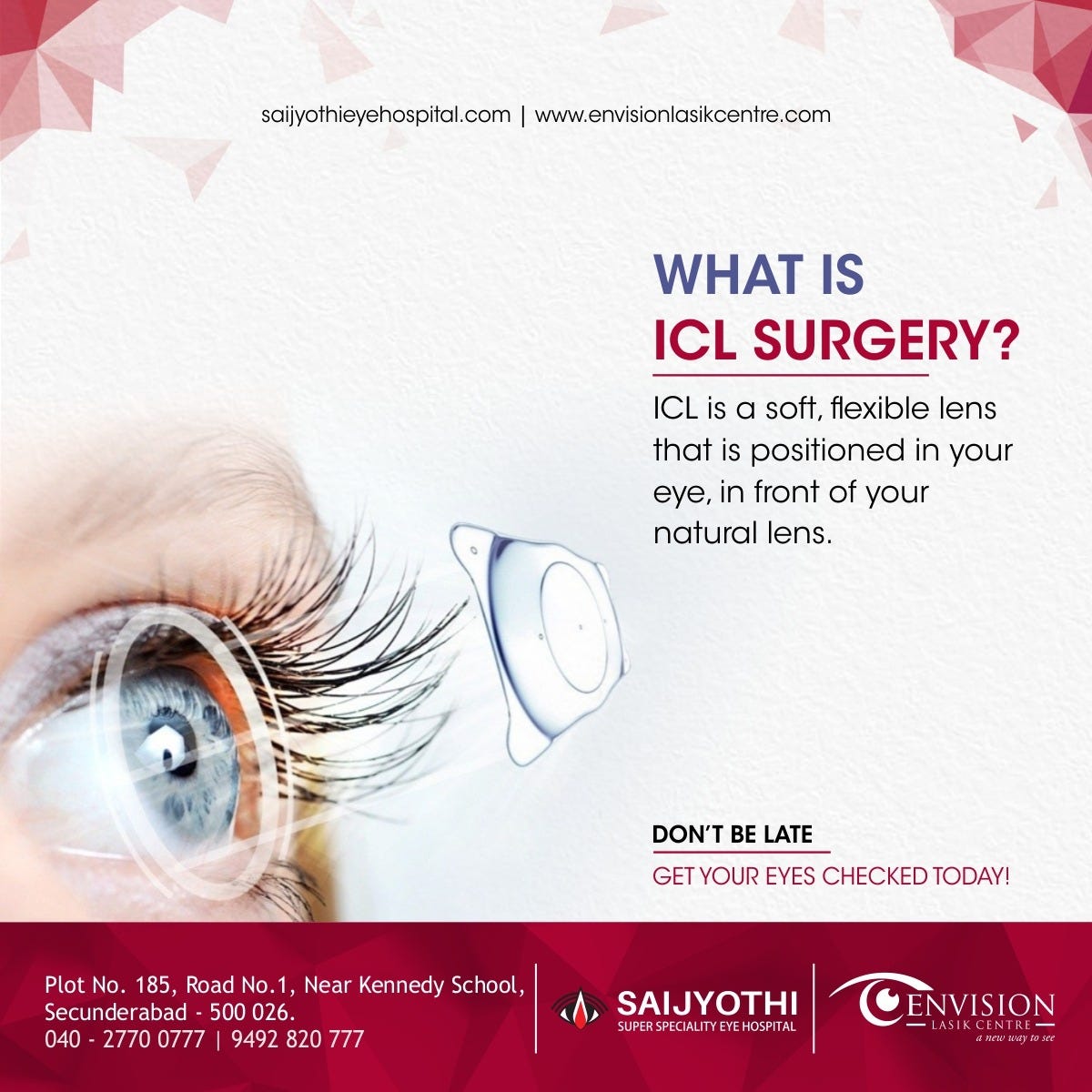 ICL Surgery Hospital in Hyderabad | by ENVISION LASIK CENTRE | Medium