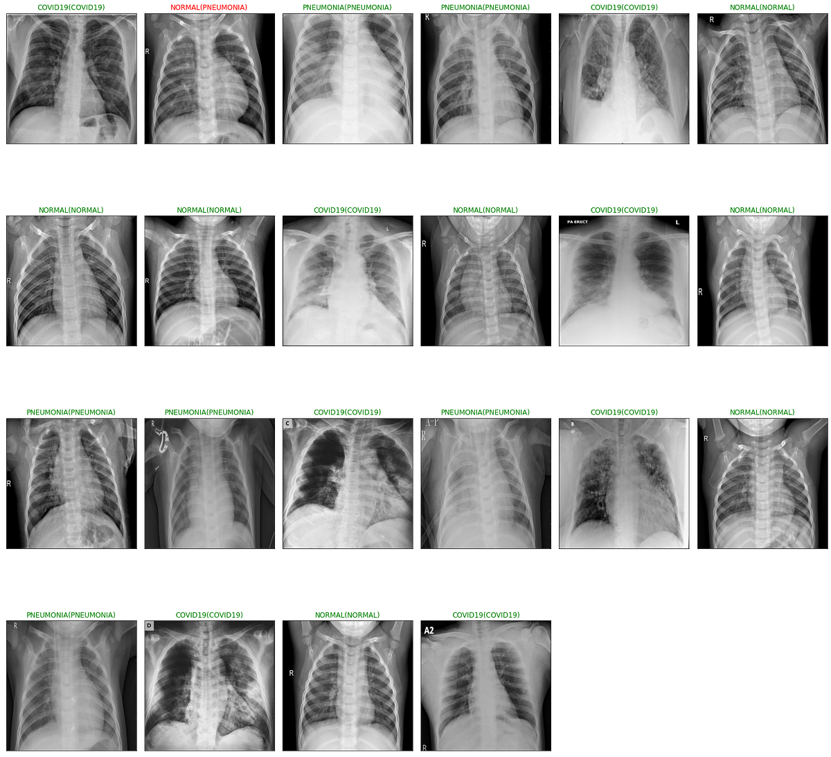 Covid-19 Early Detection from X-ray Images Aided by AI | by Said ...
