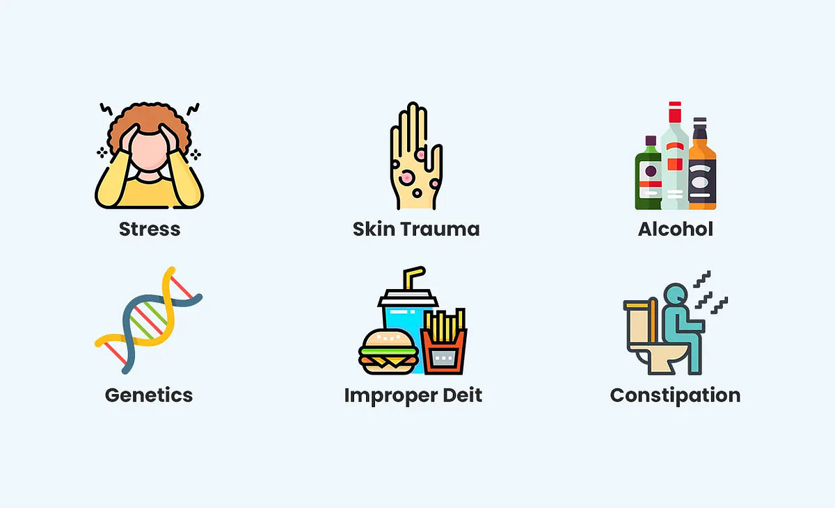 Psoriasis: Understanding its Causes, Symptoms, Types, and Treatment ...