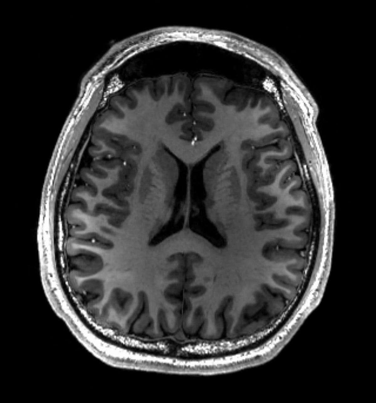 Medical Image Segmentation. 1. Architectures You’ll See in Practice ...
