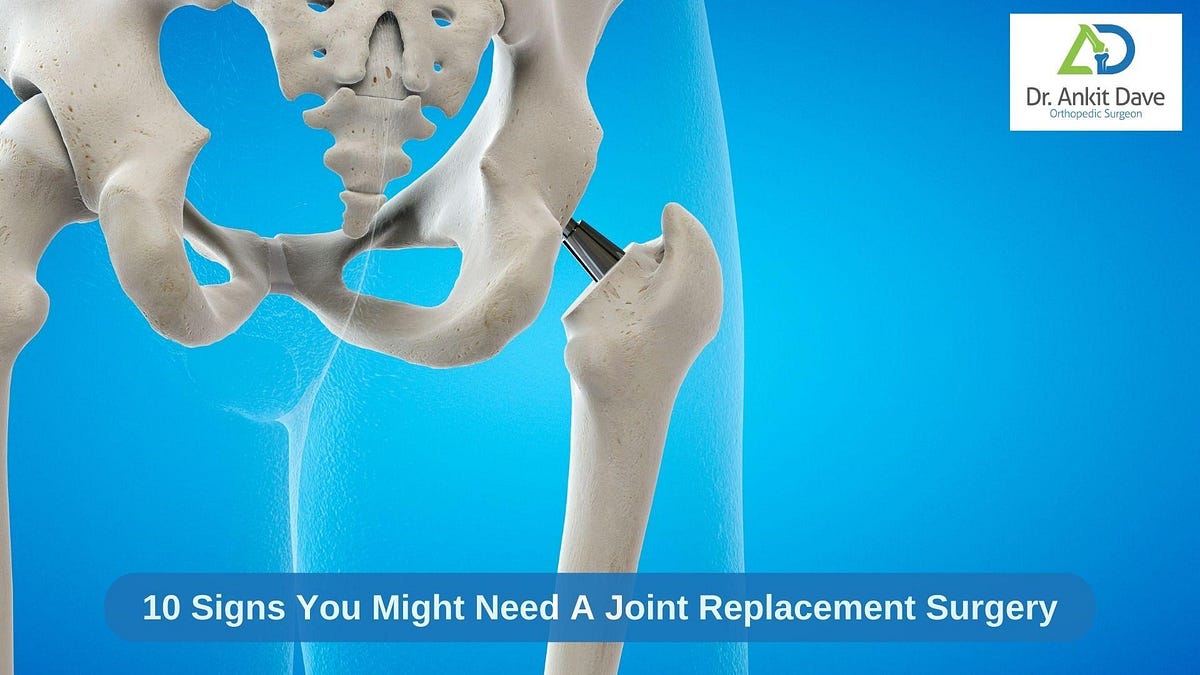 10 SIGNS THAT YOU MIGHT NEED A JOINT REPLACEMENT SURGERY | by Dr ankit ...