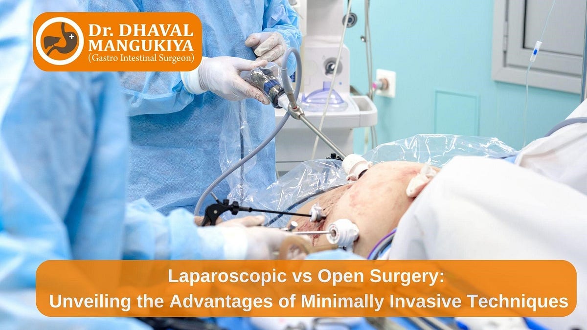 Laparoscopic vs. Open Surgery: Unveiling the Advantages of Minimally Invasive Techniques From ...