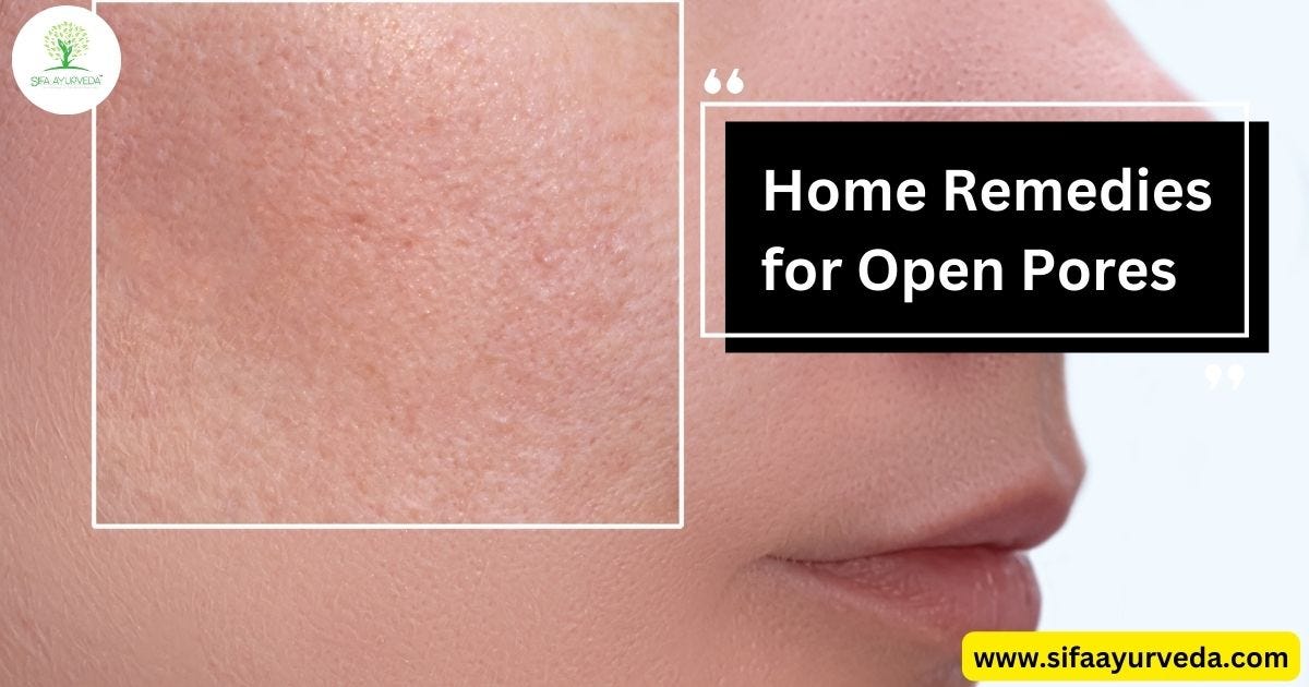 Home Remedies for Open Pores. Effective Home Remedies for Open Pores ...