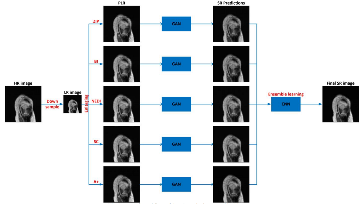 Ensemble Learning for Deep Learning-based MRI Super Resolution | by ...