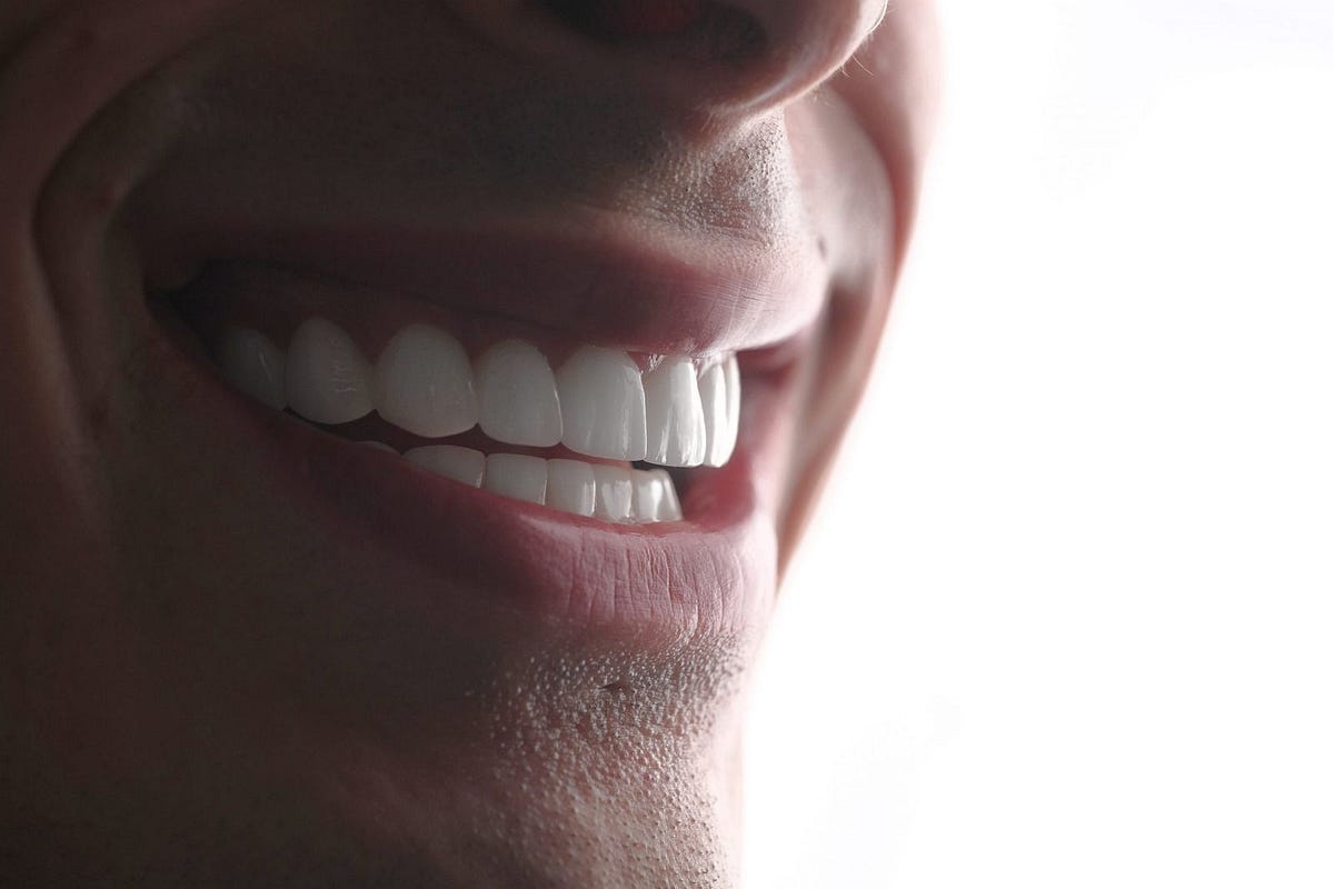 Turkey Teeth. When it comes to dental care, Turkey is… | by sevilsmile ...
