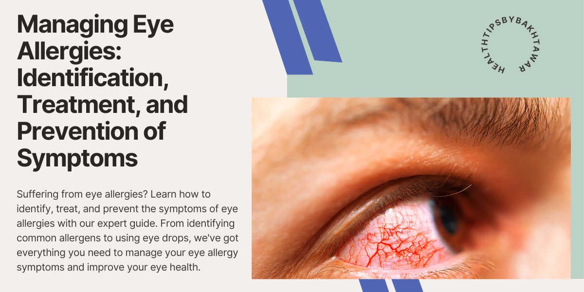 Dealing with Eye Allergy: How to Identify, Treat and Prevent Symptoms ...