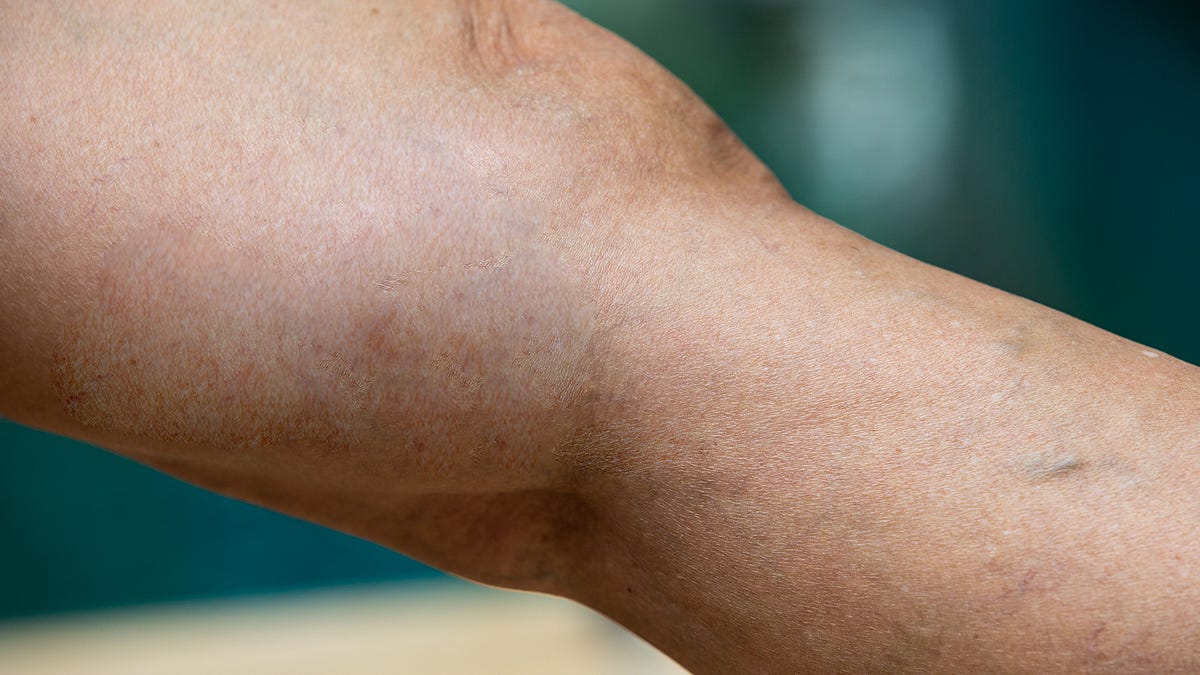 How to Reduce Inflammation Naturally? | by Jennifer A. Stephenson | Medium