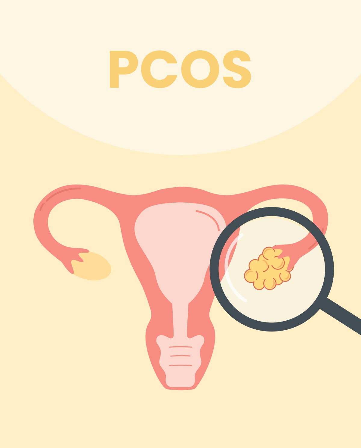 Finding the Right Homeopathic Practitioner for PCOD/PCOS Treatment | by ...
