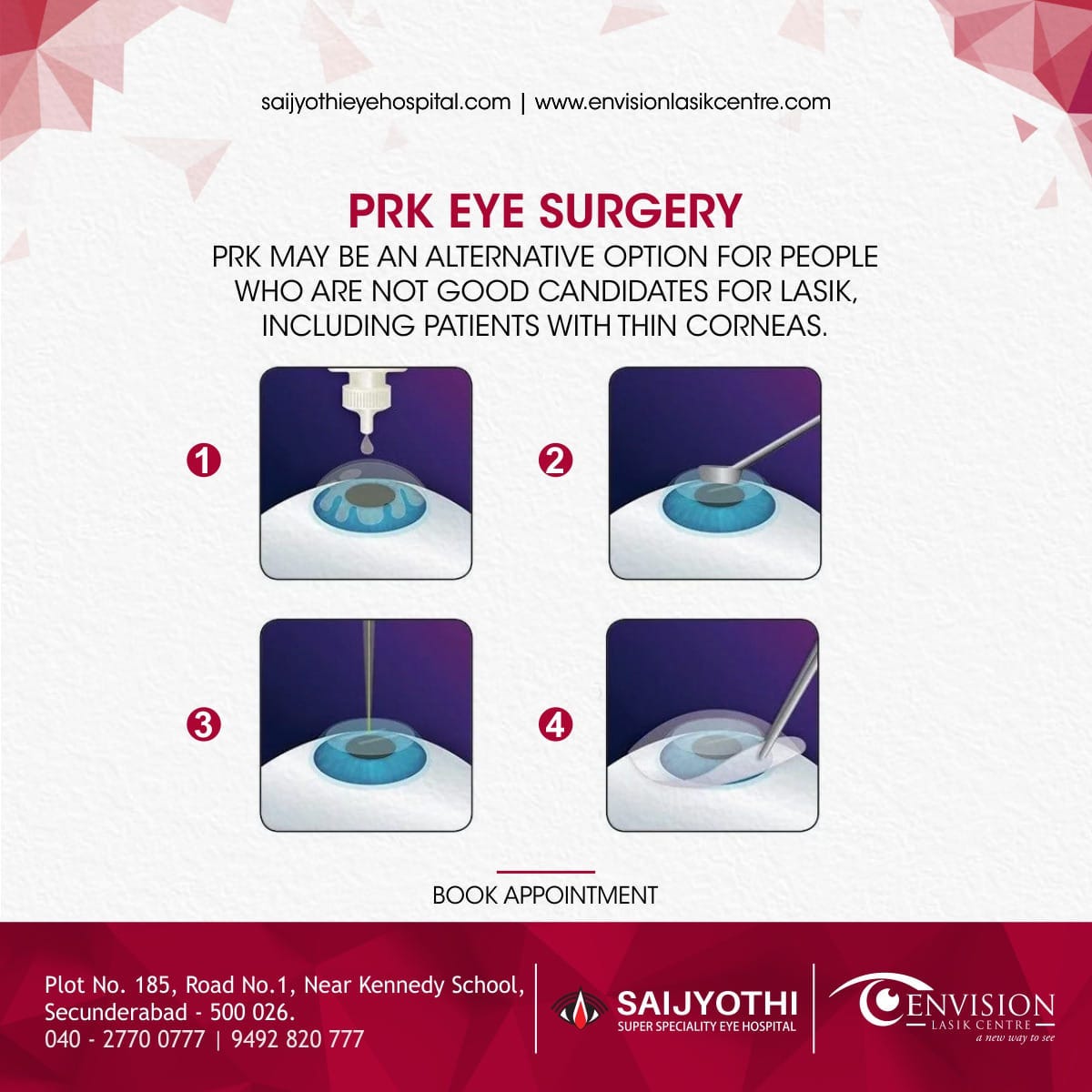 PRK Laser Treatment for Eyes - ENVISION LASIK CENTRE - Medium
