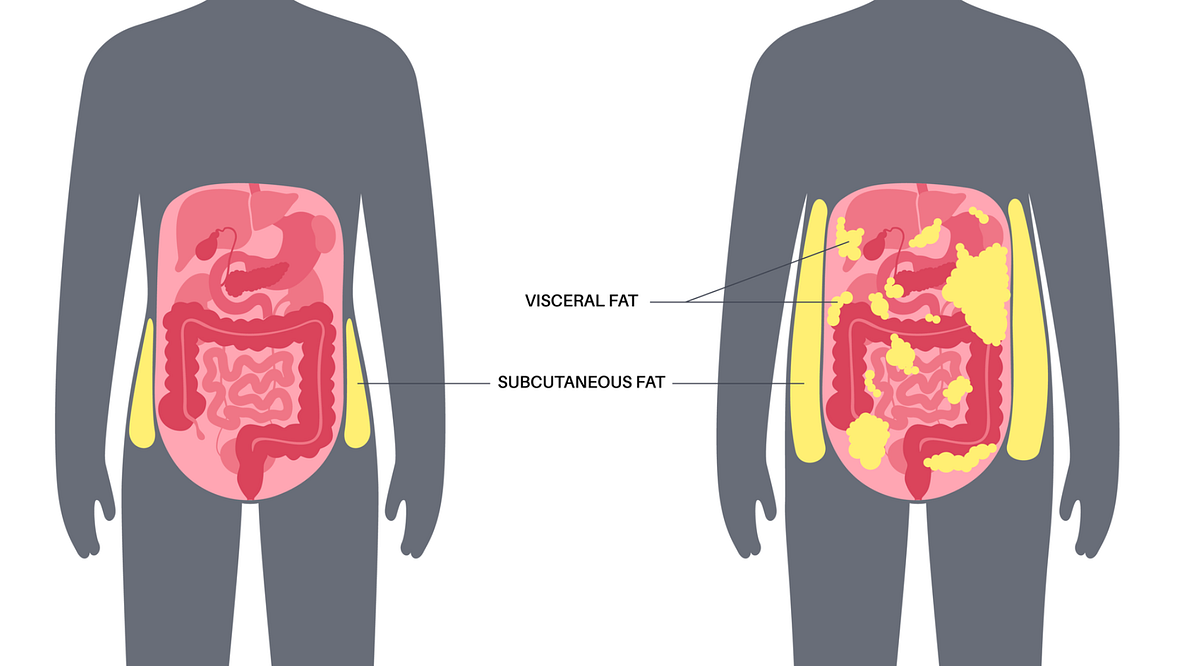 Hidden Fat Can Age Your Heart. It’s not just about weight, but where… | by Annie Foley | Wise ...