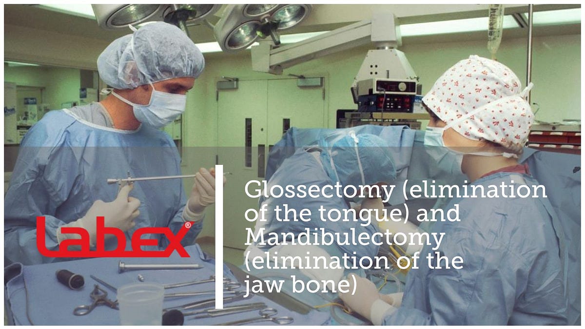 Glossectomy (elimination of the tongue) and Mandibulectomy (elimination ...